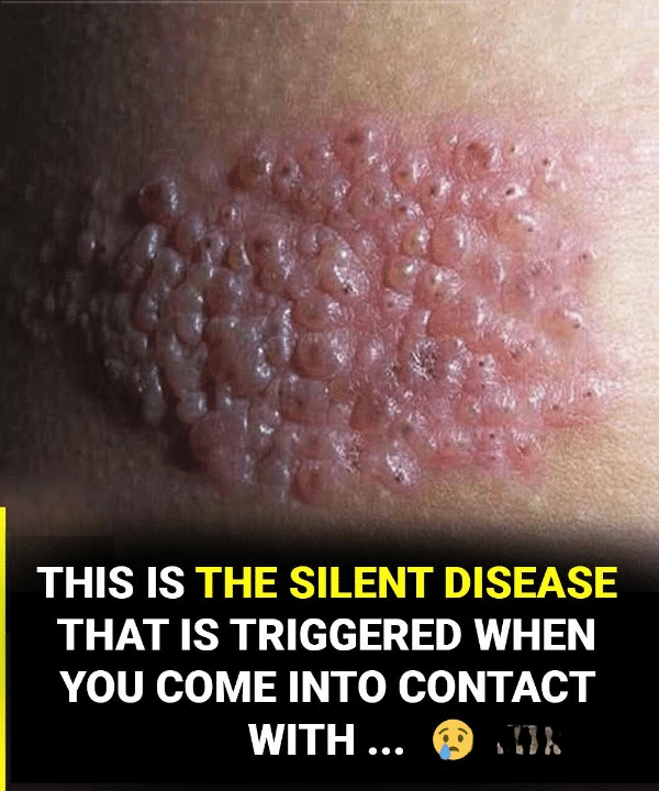 What Few People Know About This Silent Disease That Can Appear Without ...