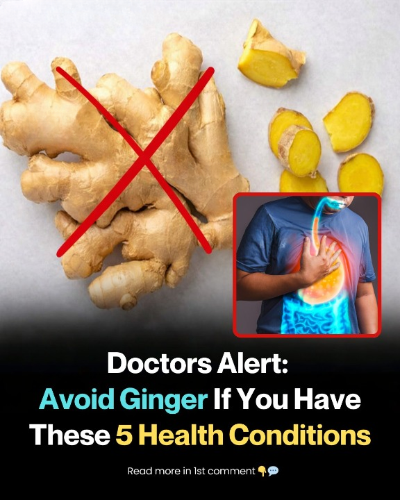 5 Types of People Who Need to Be Careful When Using Ginger ...